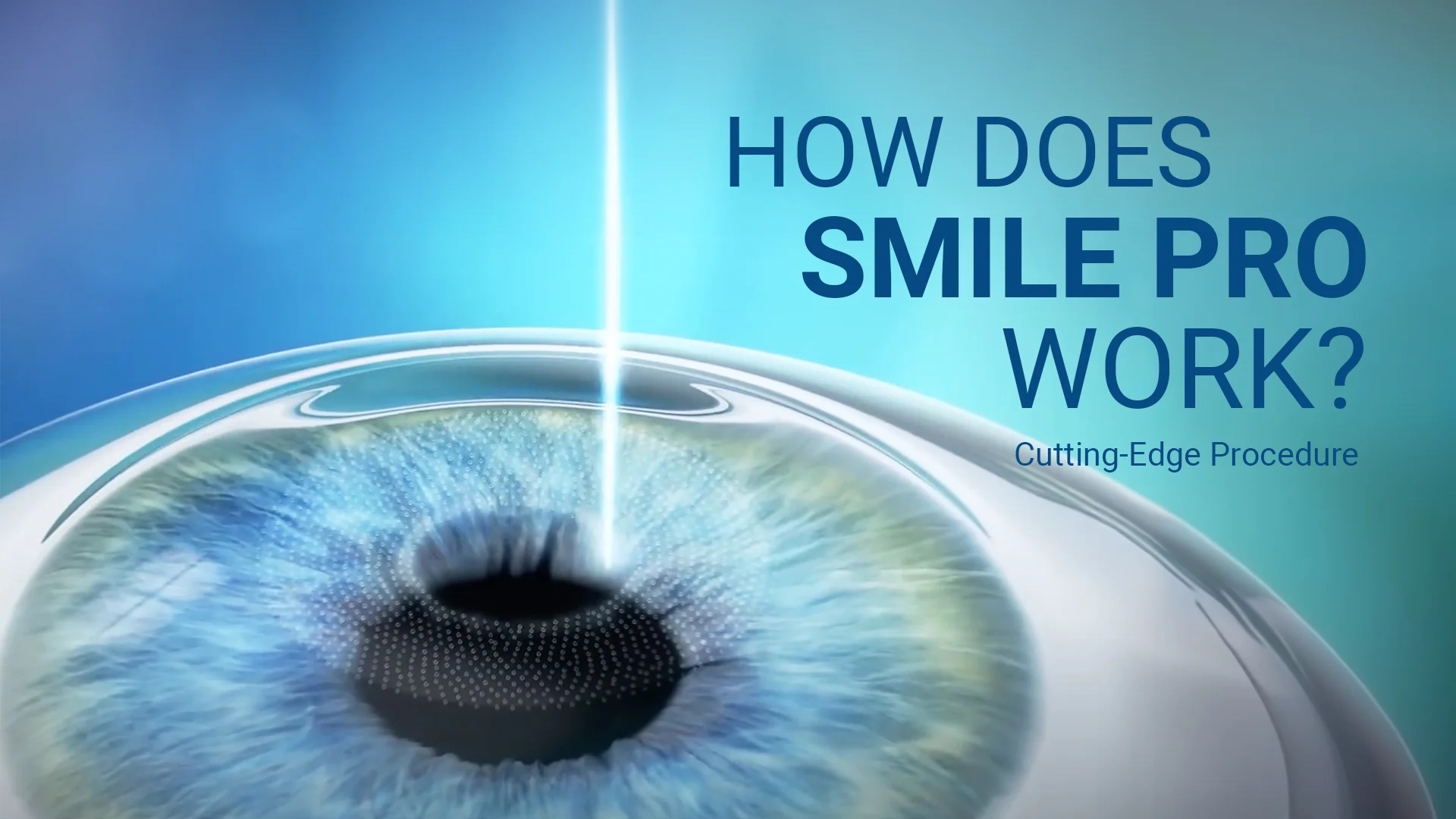 Smile Pro - Hong Kong Myopia & Presbyopia Center